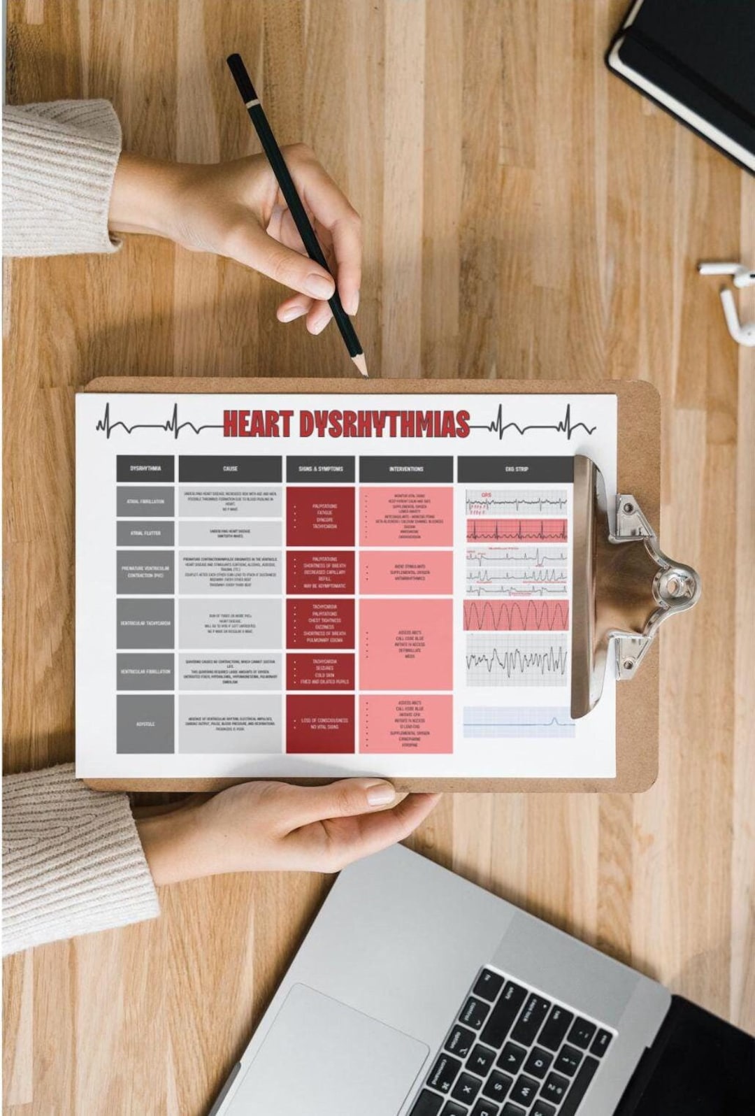 Nursing Student Heart Dysrhythmias Study Guide Notes – School Printable ...