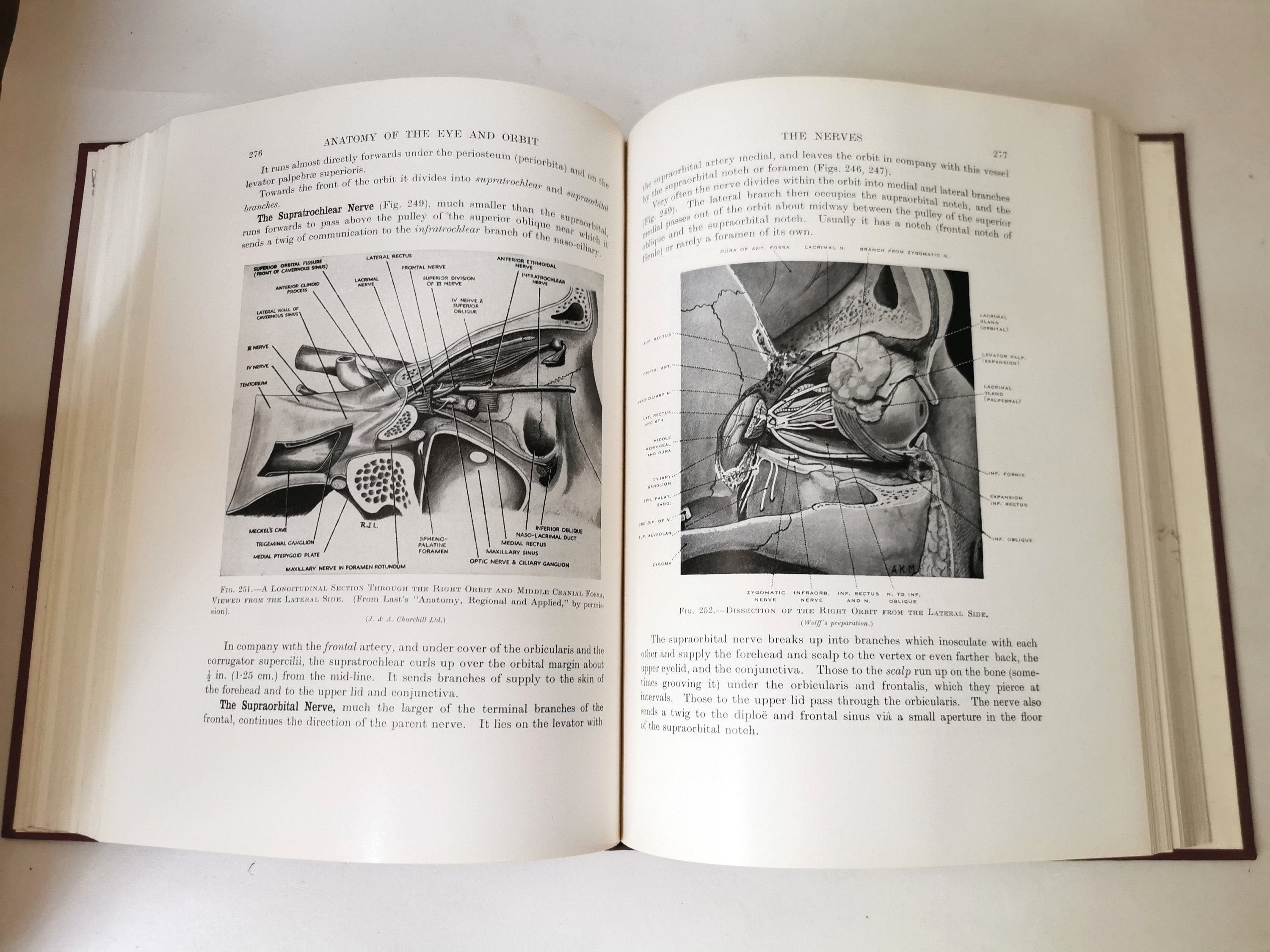 Anatomy of the Eye and Orbit 1961 Eugene Wolff, Illustrated Medical ...