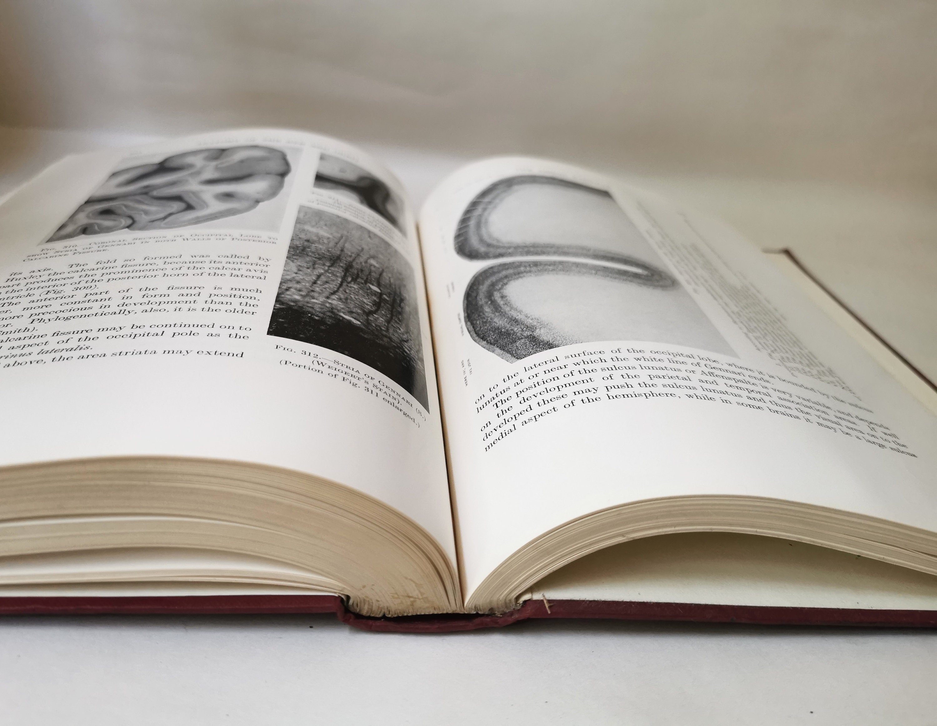Anatomy of the Eye and Orbit (1961) Eugene Wolff, Illustrated Medical ...