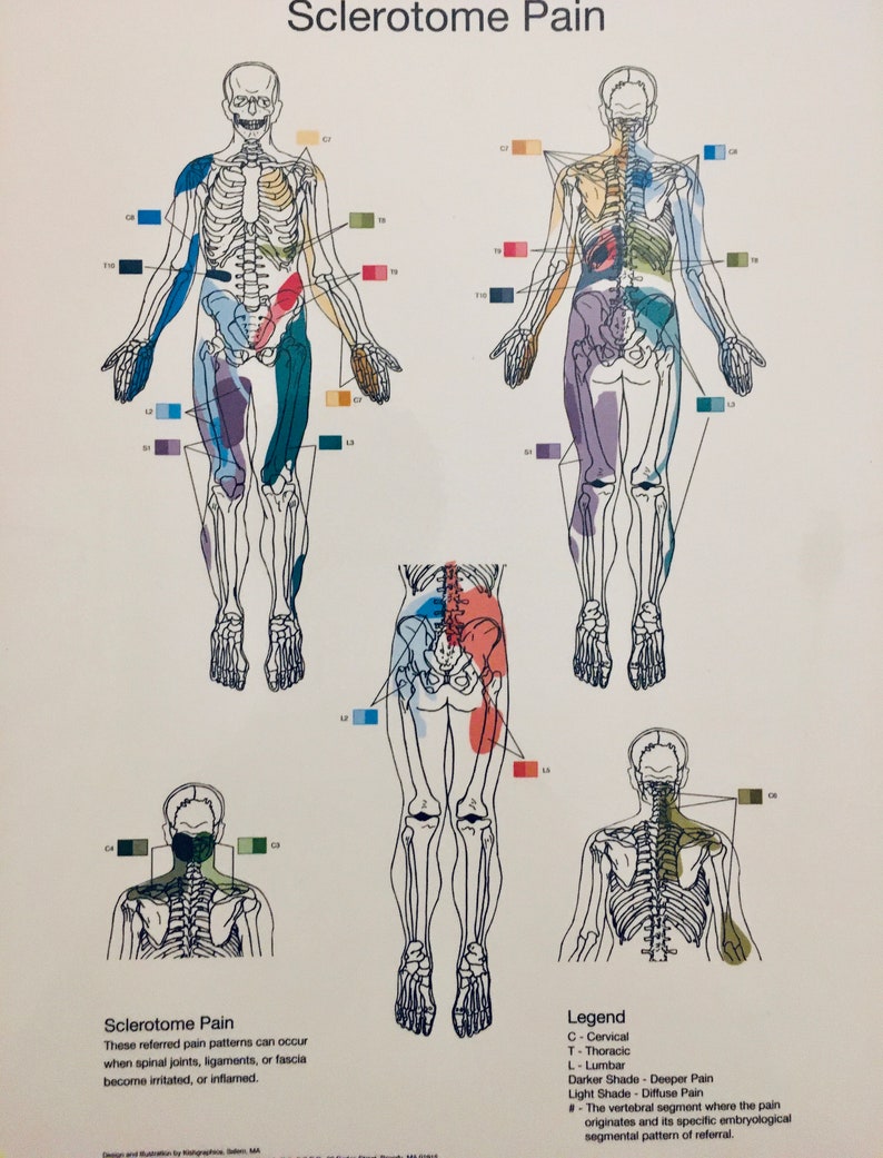 Sclerotome Poster Set - Etsy