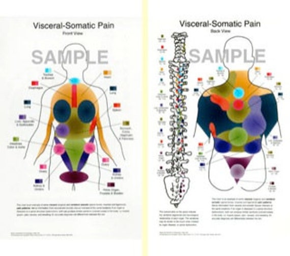 Visceral Somatic Pain Poster Set - Etsy