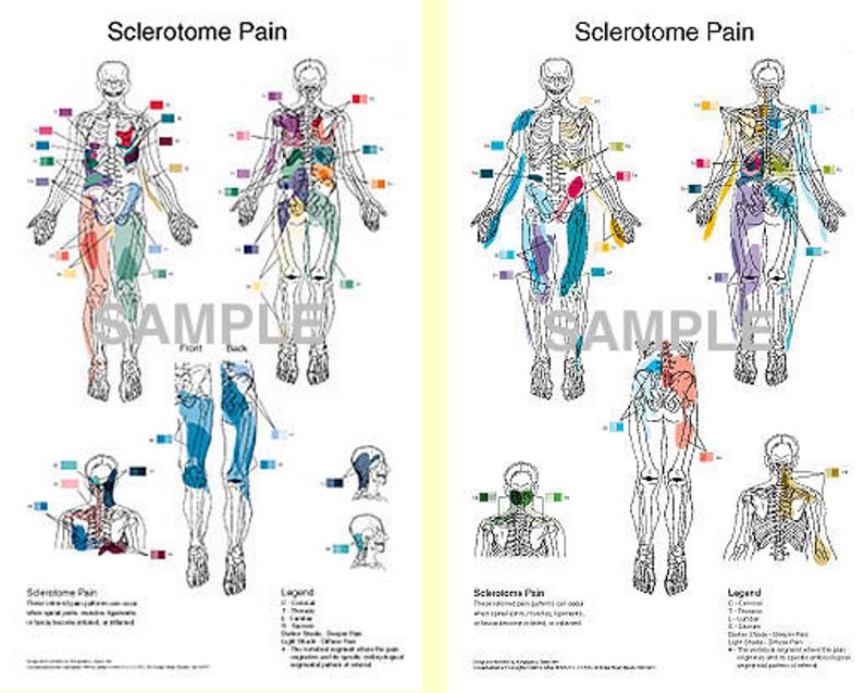Sclerotome Poster Set - Etsy