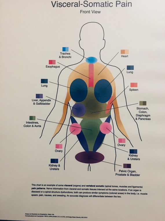 Radiating Pain Chart