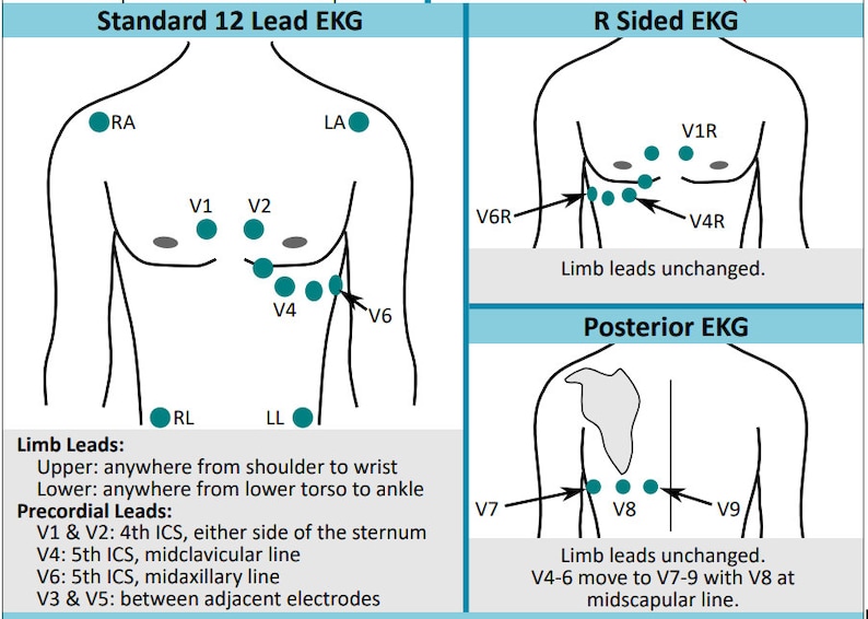 EKG Pocket Guide - Digital - Etsy