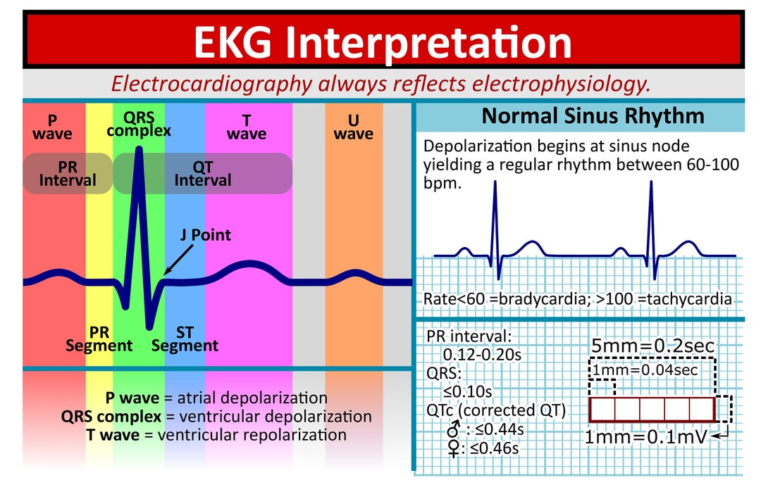 EKG Pocket Guide Digital - Etsy
