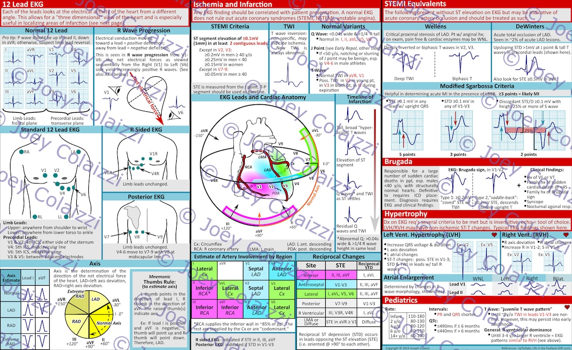 EKG Pocket Guide - Etsy