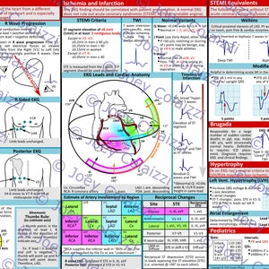 EKG Pocket Guide - Etsy
