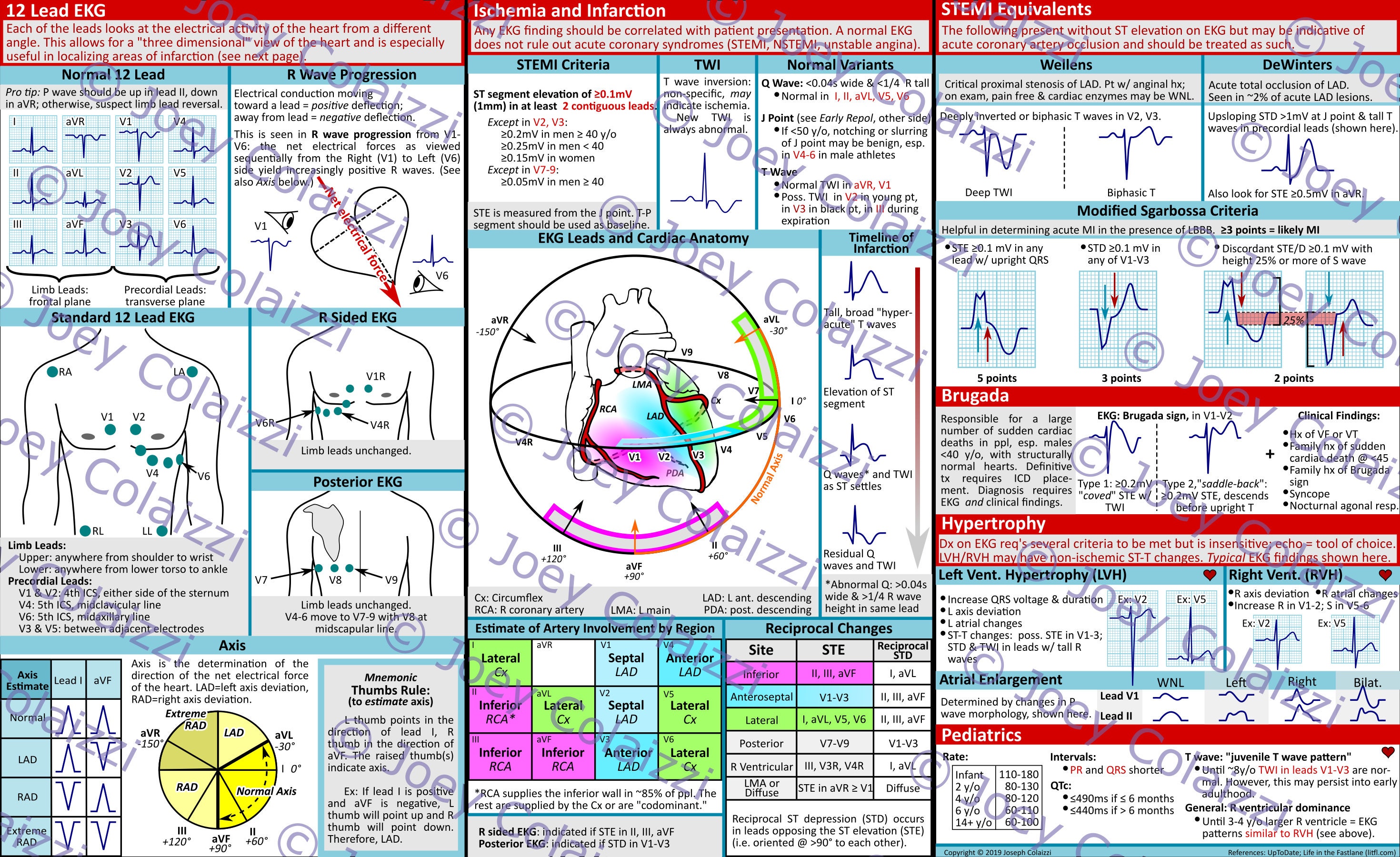 EKG Pocket Guide - Etsy