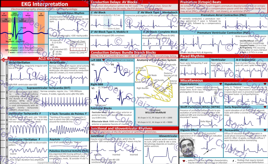 EKG Pocket Guide | Etsy