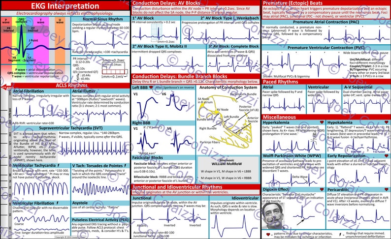 EKG Pocket Guide - Etsy