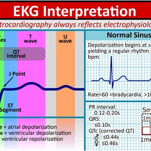 EKG Pocket Guide Digital - Etsy