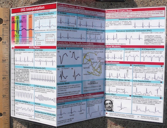 EKG Pocket Guide | Etsy