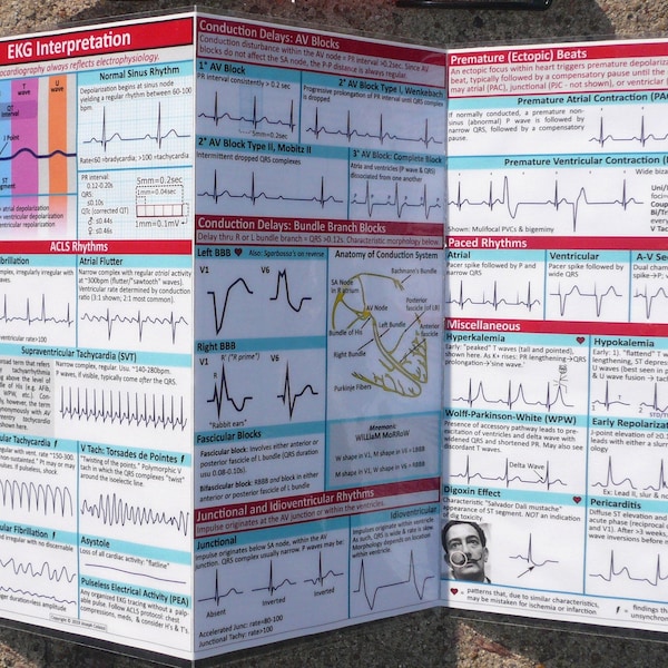 Ekg - Etsy