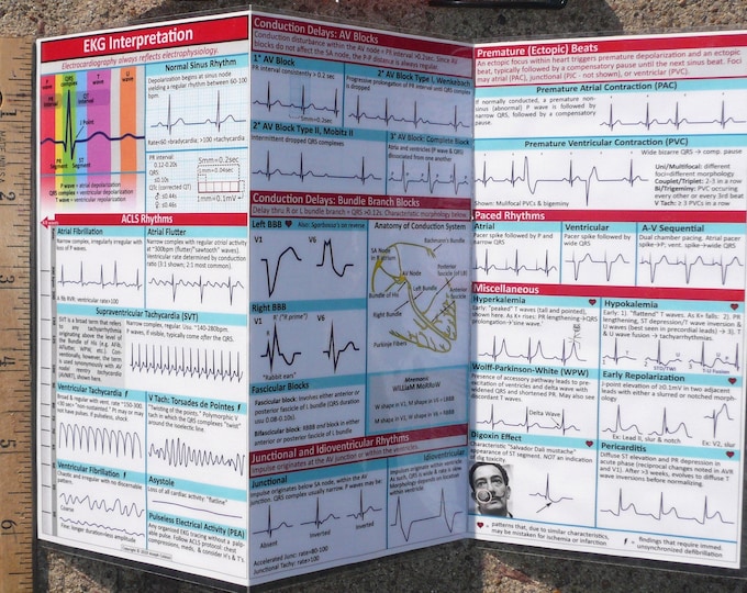 EKG Pocket Guide - Etsy