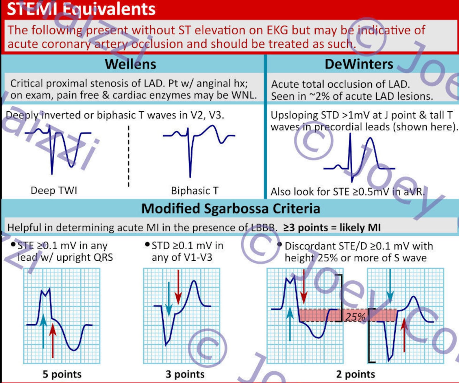 EKG Pocket Guide - Etsy