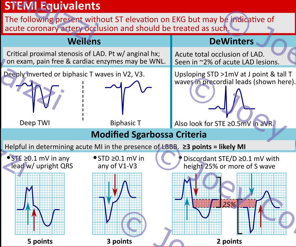EKG Pocket Guide - Etsy