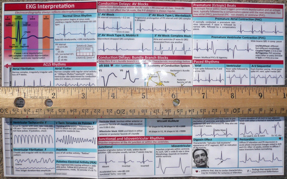 EKG Pocket Guide - Etsy