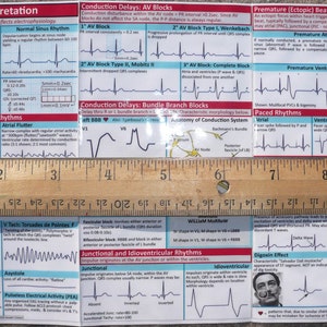 EKG Pocket Guide - Etsy