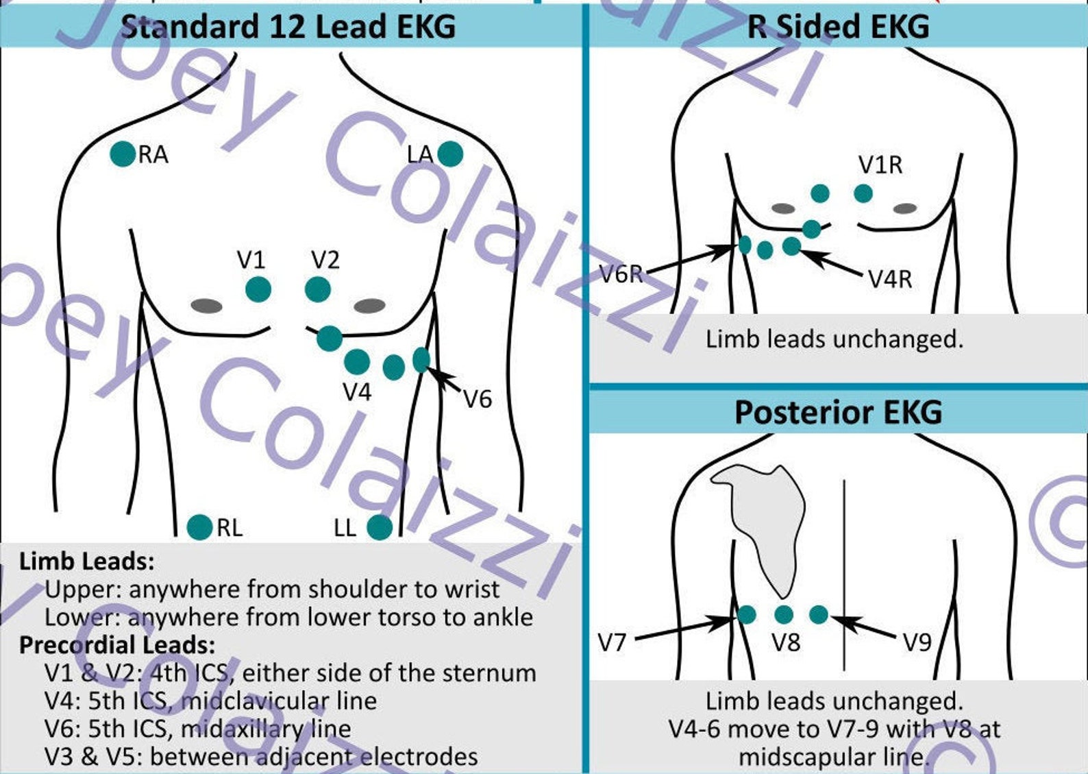 EKG Pocket Guide - Etsy
