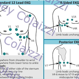 EKG Pocket Guide - Etsy