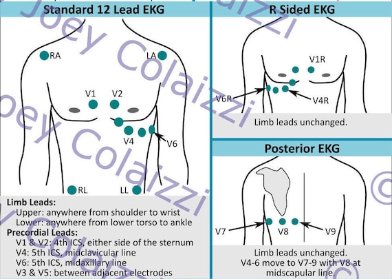 Midscapular Line
