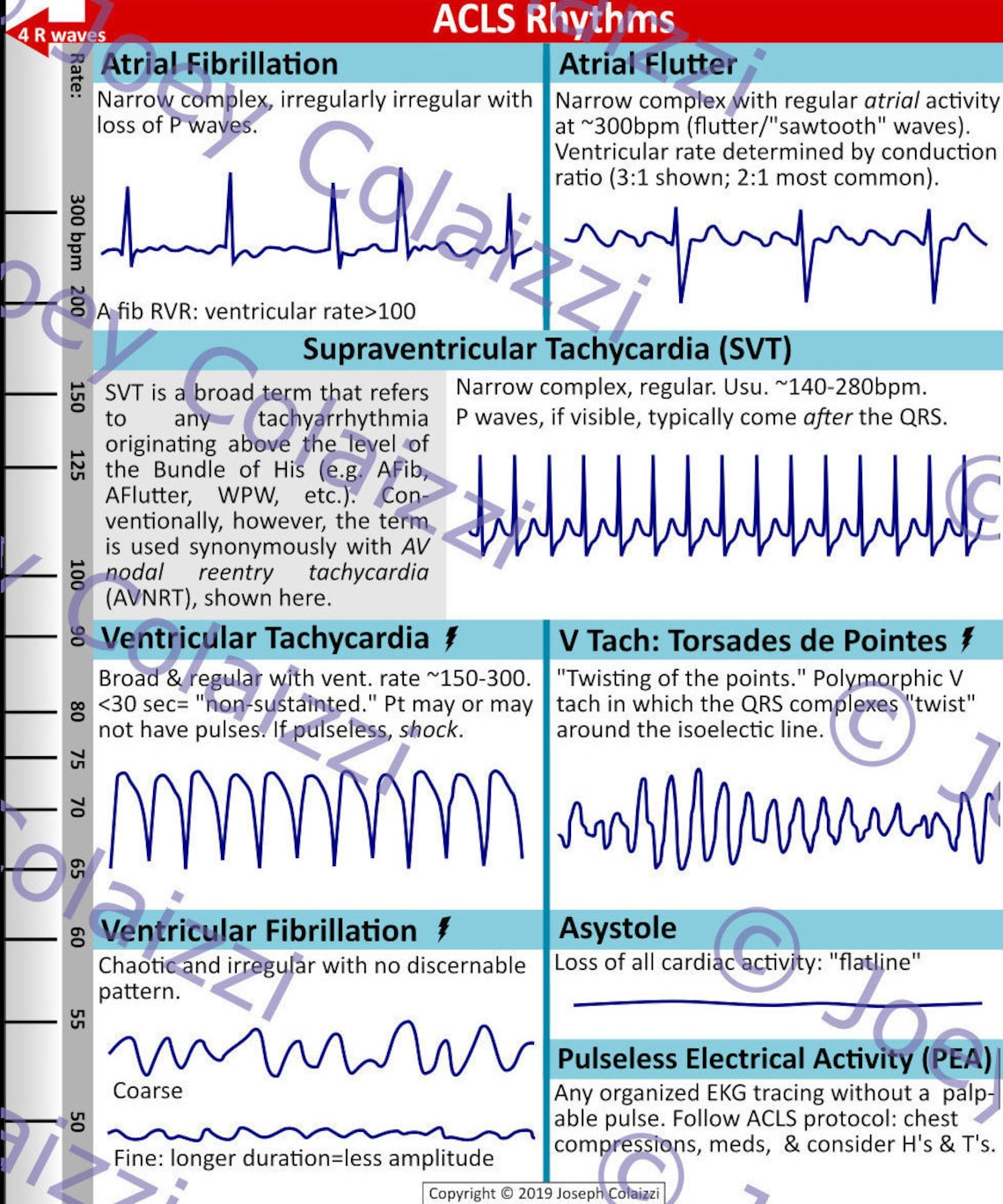 EKG Pocket Guide - Etsy Australia