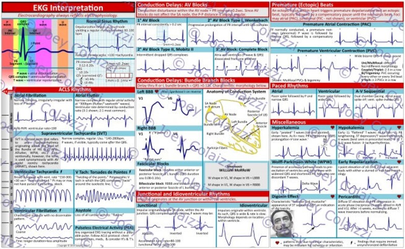 EKG Pocket Guide - Digital - Etsy