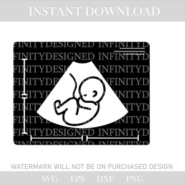 Pregnant Ultrasound Svg - Etsy