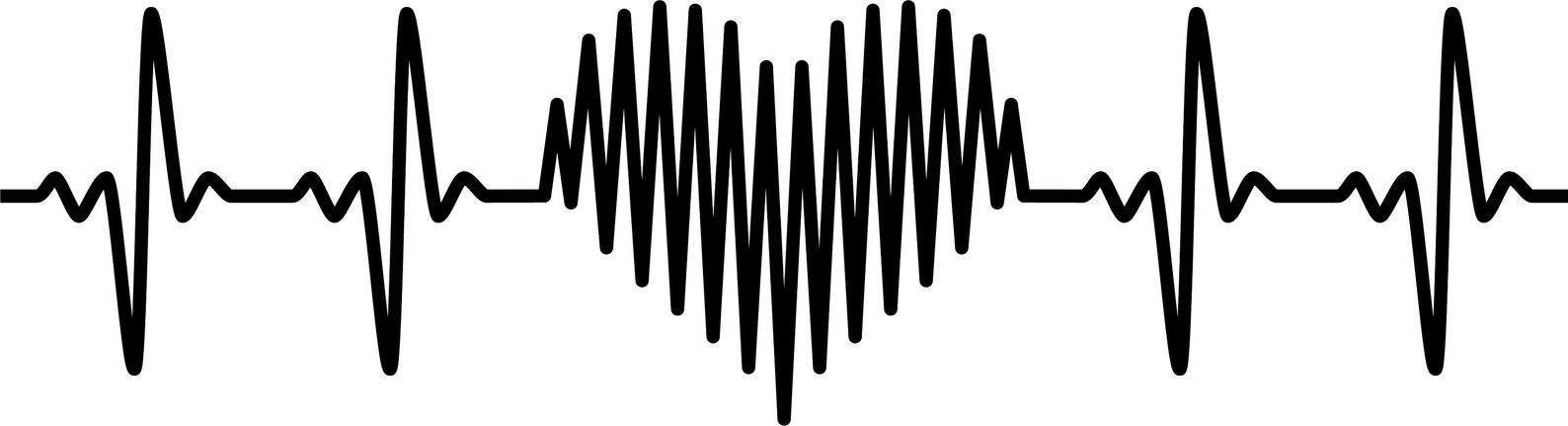 Heartbeat EKG Pulse SVG | Heartbeat Line SVG | Heartbeat Pulse | Cricut ...