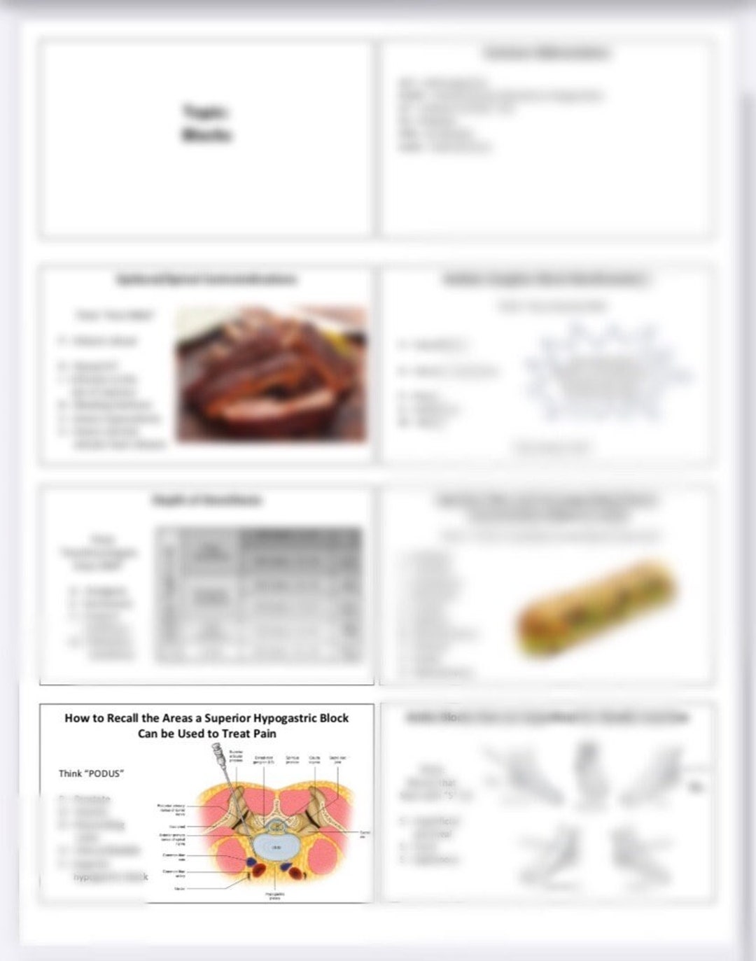 CRNA School Mnemonic Cards - Blocks - Etsy