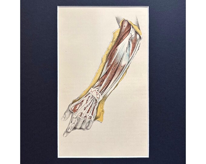 Antique Anatomy Print, Fore Arm Section, Printed in 1882 , NYC ...