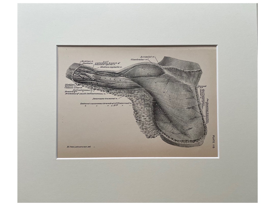 Anatomy Print, 1888 NYC, Autopsy Print, Antique Print, Dissection Print ...