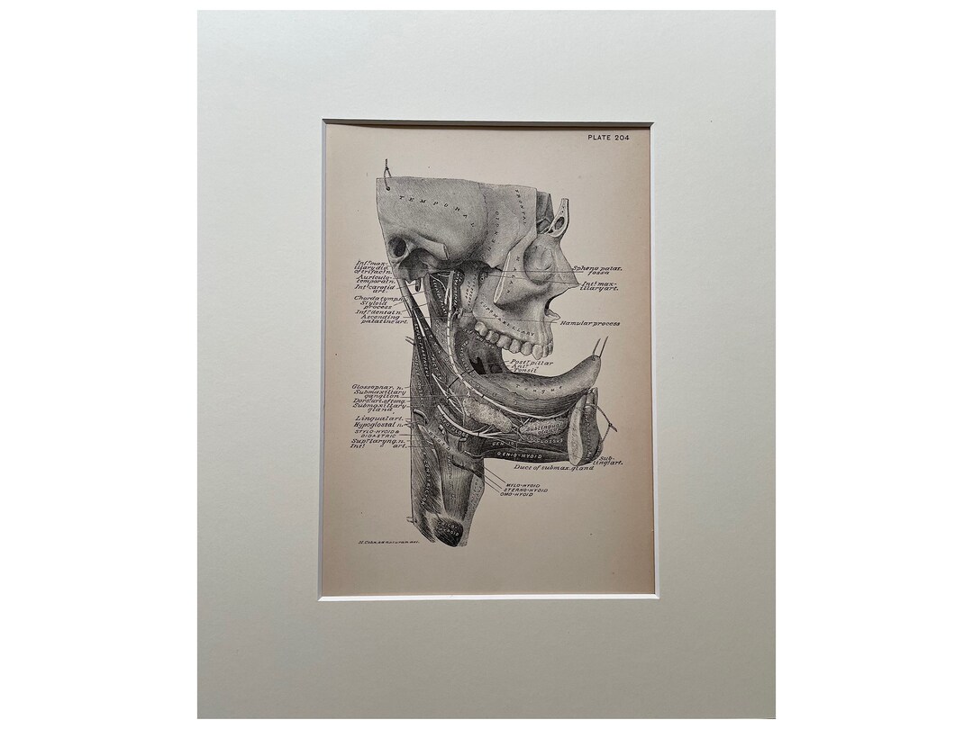 Anatomy Print, 1888 NYC, Autopsy Print, Antique Print, Dissection Print ...