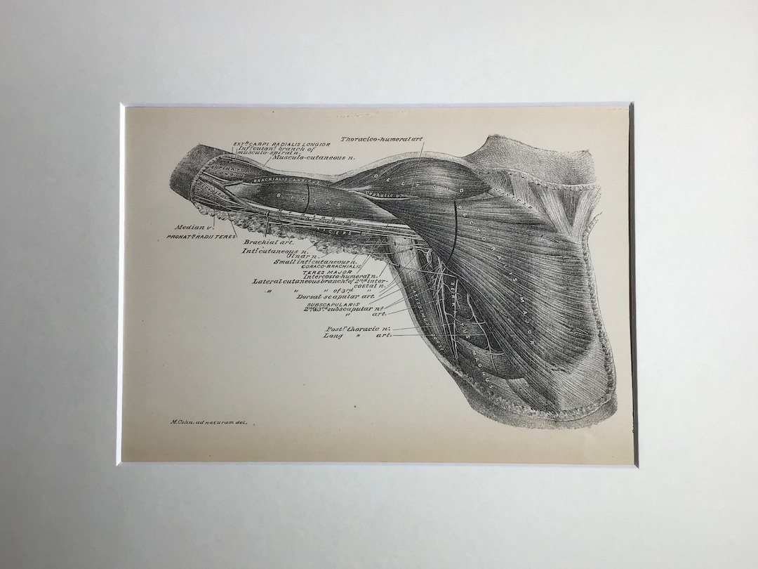 Anatomy Print, 1888 NYC, Autopsy Print, Antique Print, Dissection Print ...