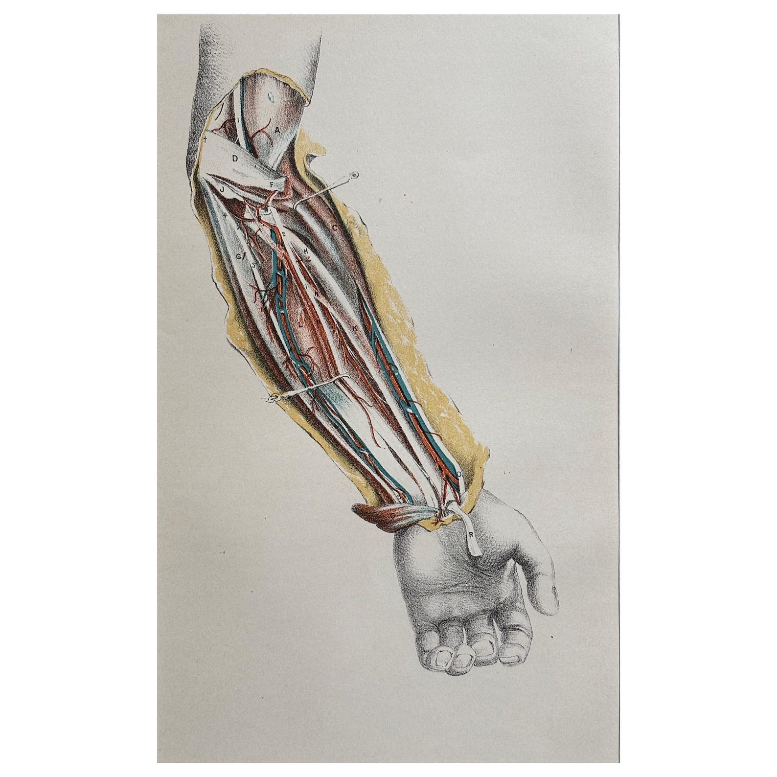 Antique Anatomy Print, Fore Arm Section, Printed in 1882 , NYC ...