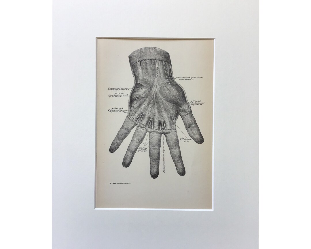 Antique Anatomy Print, Hand Print , Printed in NYC 1888, Mounted Print ...