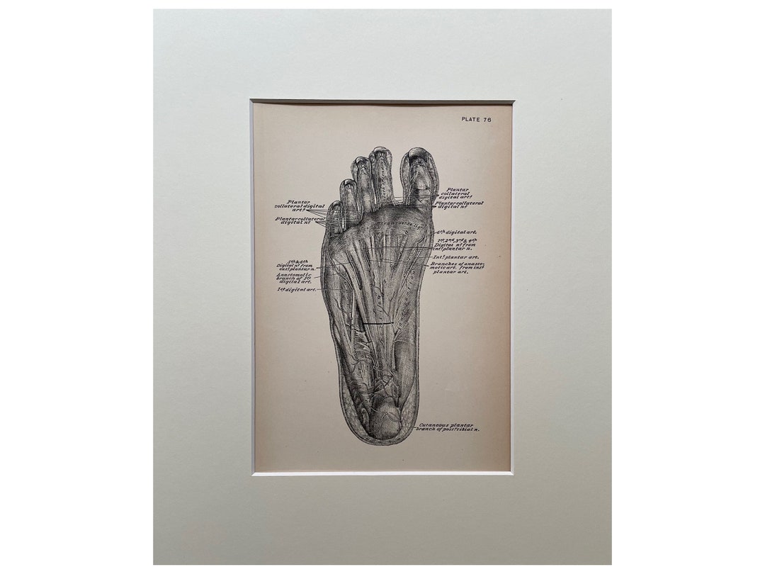 Anatomy Print, 1888 NYC, Autopsy Print, Antique Print, Dissection Print ...