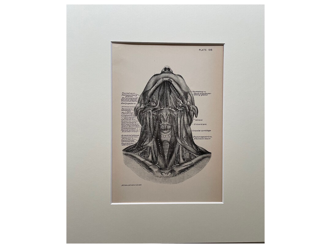 Anatomy Print, 1888 NYC, Autopsy Print, Antique Print, Dissection Print ...