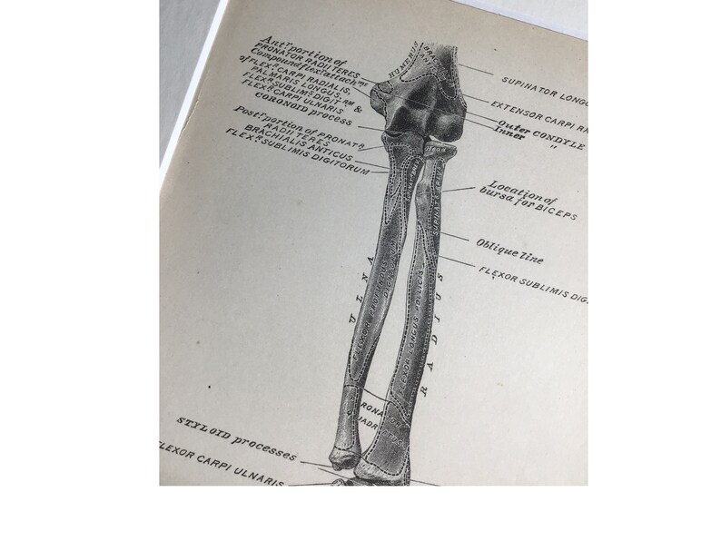 Anatomy Print, 1888 NYC, Autopsy Print, Antique Print, Dissection Print ...