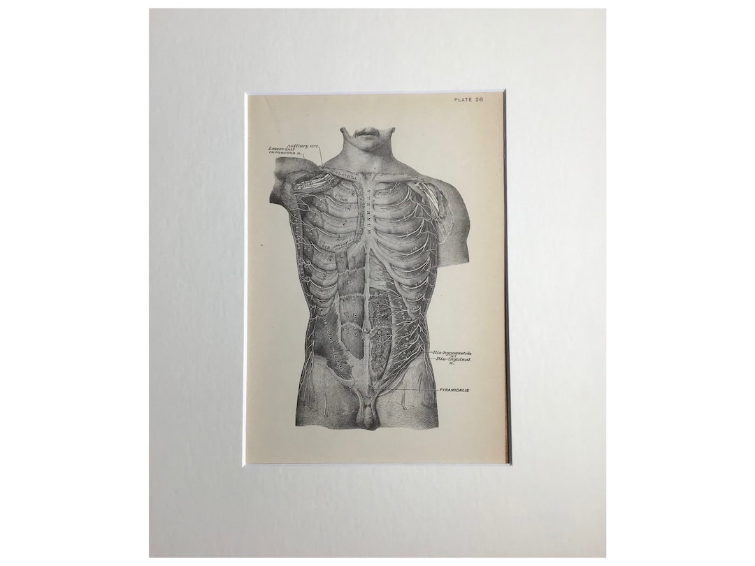 Anatomy Print, 1888 NYC, Autopsy Print, Antique Print, Dissection Print ...