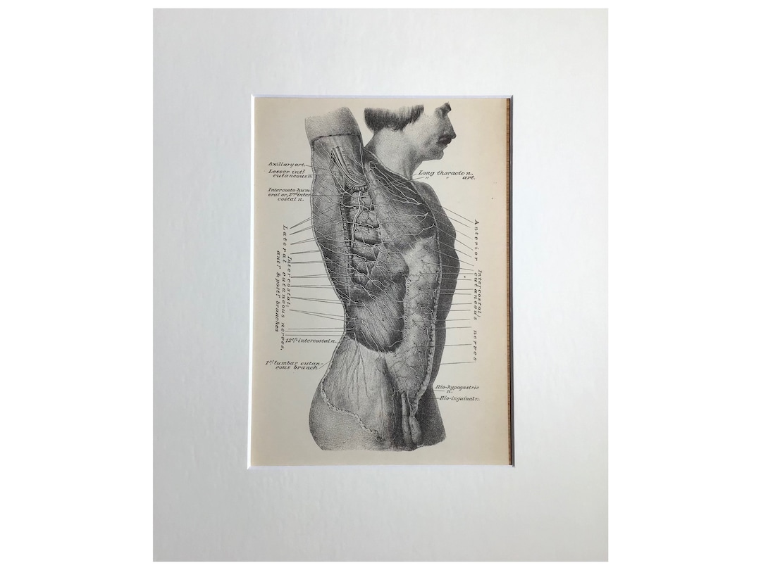 Anatomy Print, 1888 NYC, Autopsy Print, Antique Print, Dissection Print ...