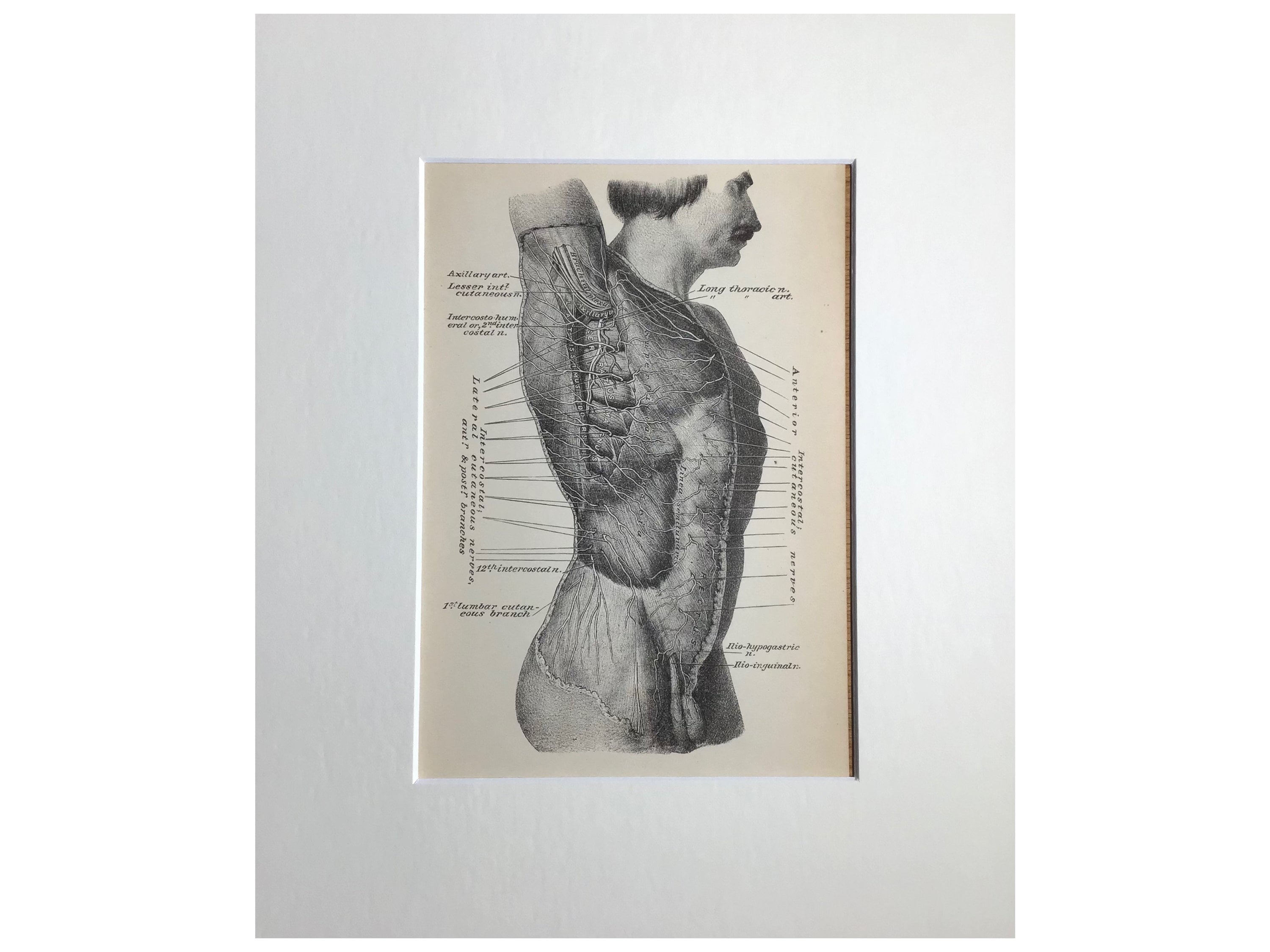Anatomy Print, 1888 NYC, Autopsy Print, Antique Print, Dissection Print ...