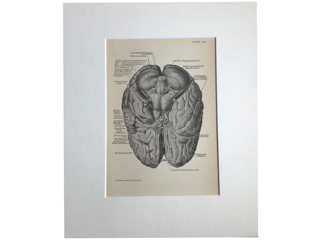 Anatomy Print, 1888 NYC, Autopsy Print, Antique Print, Dissection Print ...