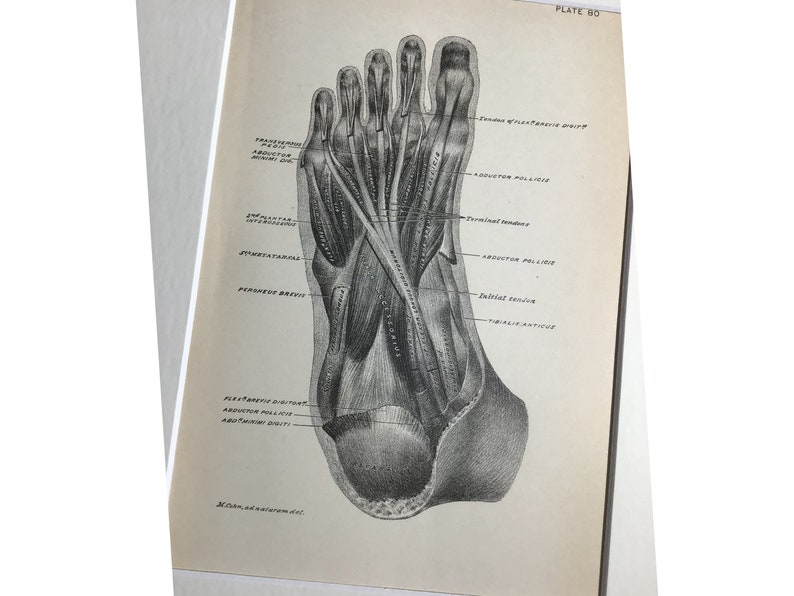 Anatomy Print, 1888 NYC, Autopsy Print, Antique Print, Dissection Print ...
