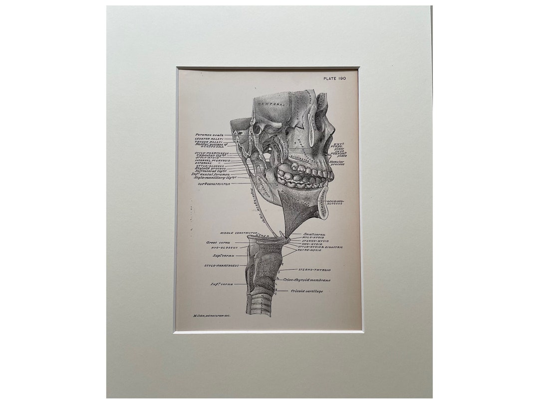 Anatomy Print, 1888 NYC, Autopsy Print, Antique Print, Dissection Print ...