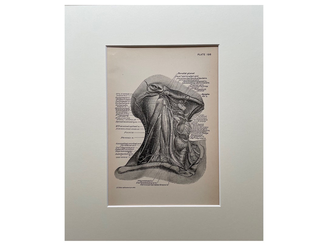 Anatomy Print, 1888 NYC, Autopsy Print, Antique Print, Dissection Print ...