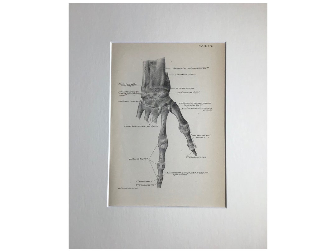Antique Anatomy Print, Hand Print , Printed in NYC 1888, Mounted Print ...