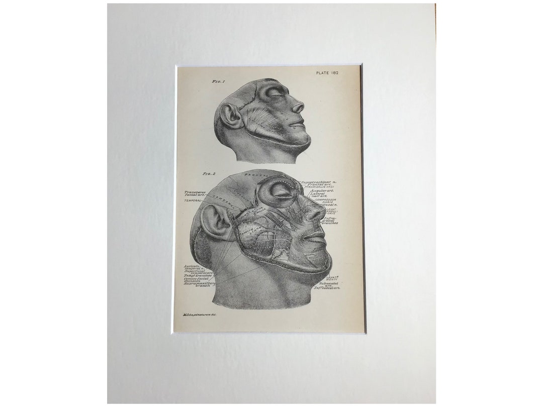 Anatomy Print, 1888 NYC, Autopsy Print, Antique Print, Dissection Print ...