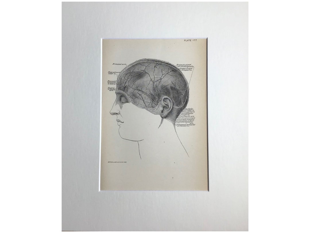 Anatomy Print, 1888 NYC, Autopsy Print, Antique Print, Dissection Print ...