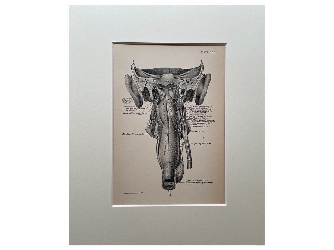 Anatomy Print, 1888 NYC, Autopsy Print, Antique Print, Dissection Print ...